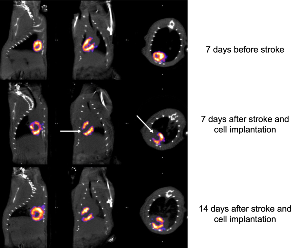 Imaging heart remodelling with [99mTc]MIBI in a rat model for stroke ...