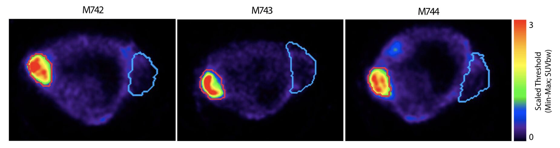 Monitoring Therapeutic Response to Anti-Fibroblast Activation Protein ...