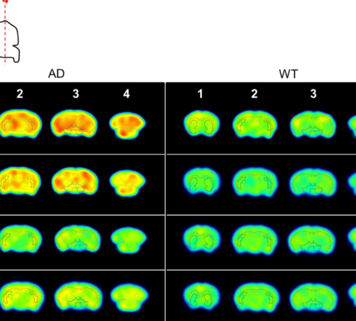 Longitudinal evaluation of a novel BChE PET tracer as an early in vivo ...